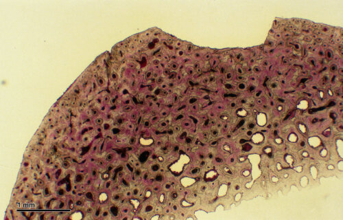 Your Next Flight May Be Designed by Slime Mold and Human Bones - The ...
